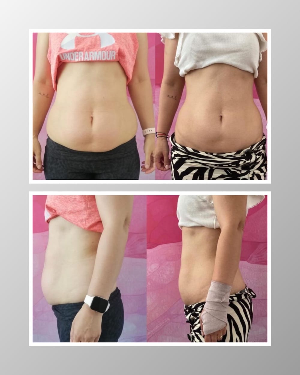 Chill Body - Chill Cryotherapy - Westfield